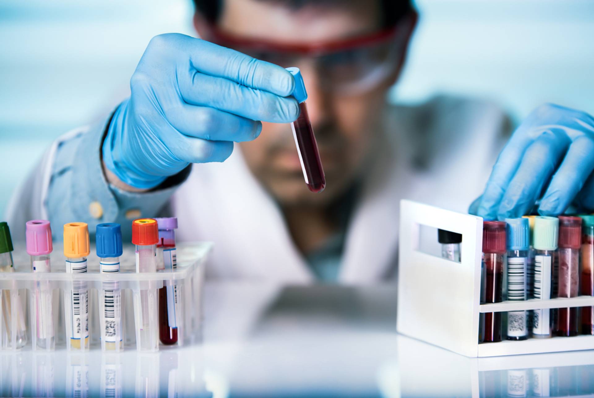 Ce sunt trigliceridele și cum reduci nivelul acestora - Bioclinica