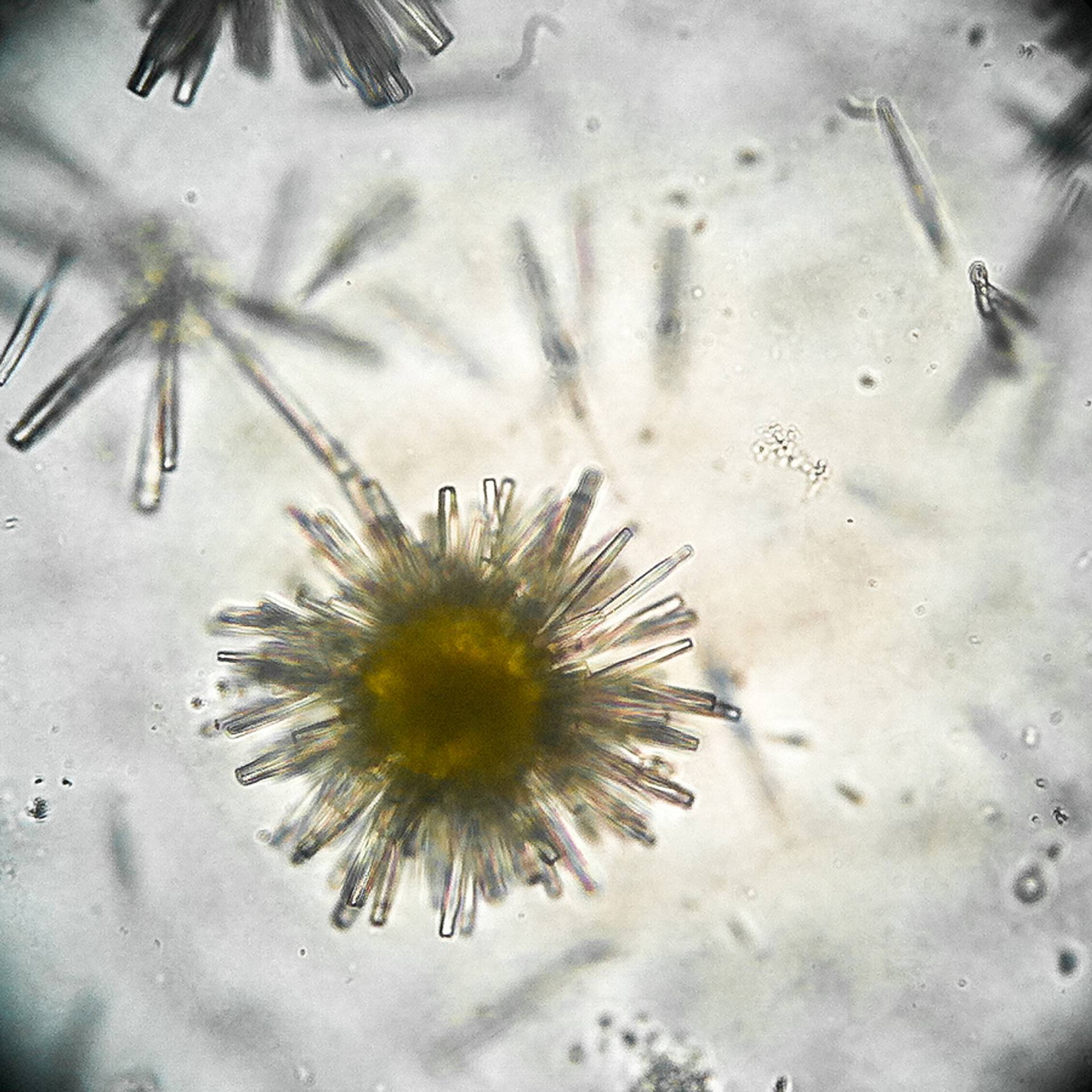 Examen sumar de urină - Bioclinica